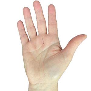 Prof. Dr. Steinsträßer - Plastische und Ästhetische Chirurgie in Oldenburg